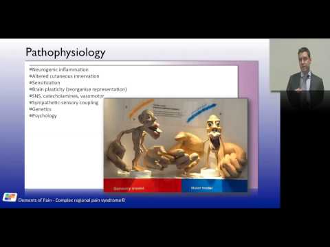 20. Complex regional pain syndrome (CRPS)