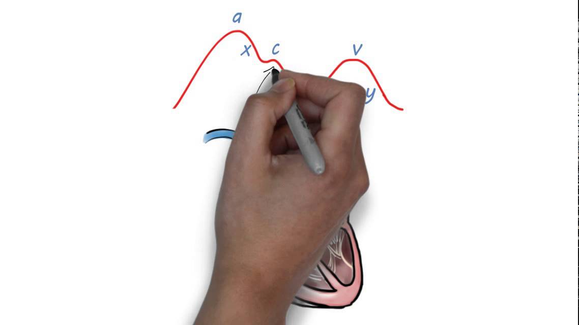 JVP waveform explained