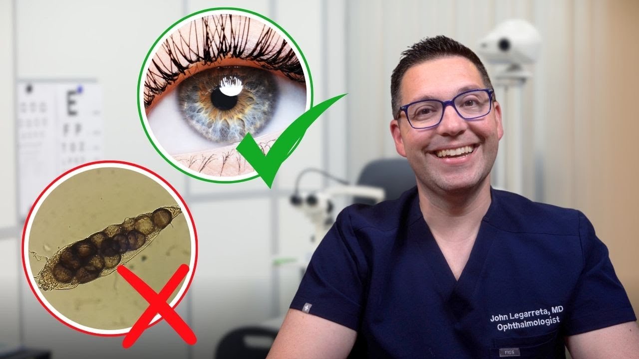 Demodex Blepharitis: The Hidden Eye Condition You Need to Know