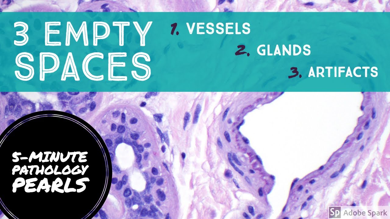 Skin Histology: Blood Vessel vs Gland vs Artifact: 5-Minute Pathology Pearls