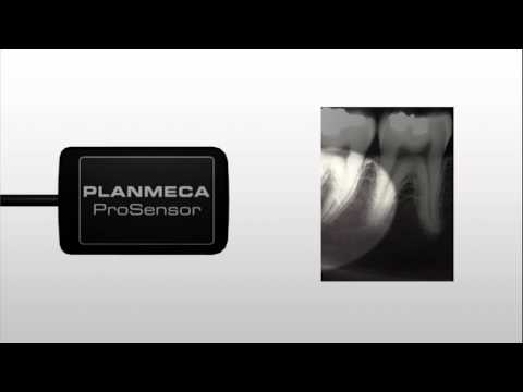 Planmeca ProSensor HD — система компьютерной визиографии купить по ...