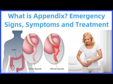 What is Appendix? Emergency Signs, Symptoms and Treatment