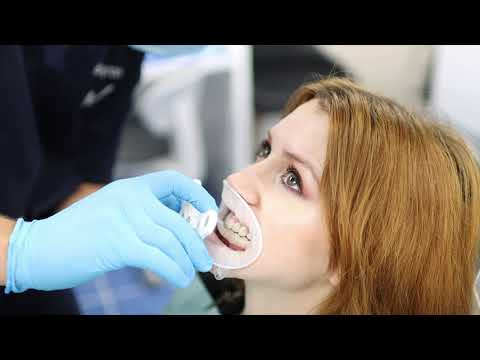 Modjaw 3D Jaw Motion - Naenae Dental Clinic NZ