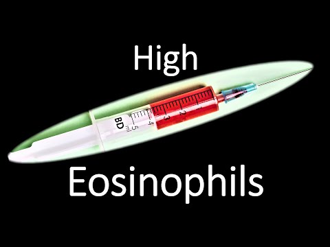Eosinophil High in blood Test Means , Eosinophils , causes of High Eosinophil count in blood.