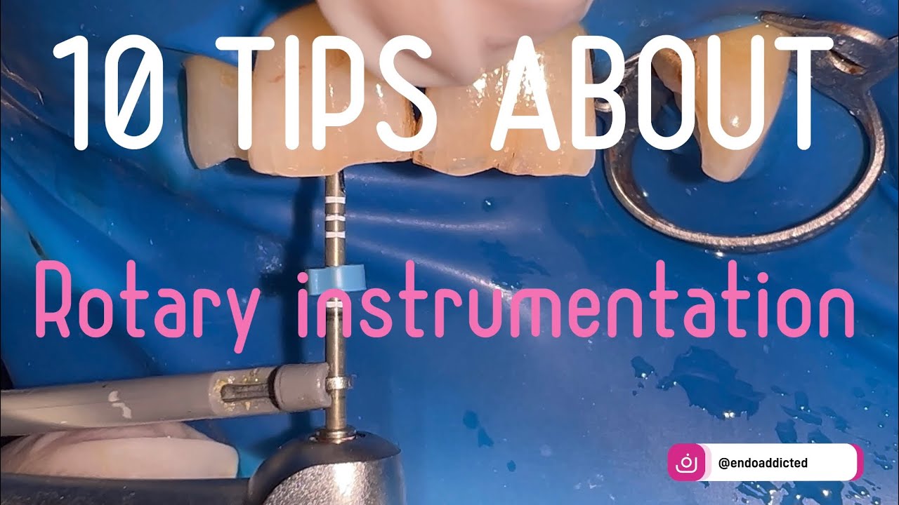 10 TIPS IN ROTARY INSTRUMENTATION