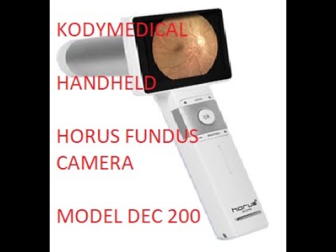 Diabetic Retinopathy - Horus DEC200 Handheld Digital Eye Fundus Camera ...