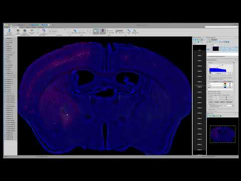 Webinar: Performing Brain-Wide Measurements and Mapping them NeuroInfo and BrainMaker