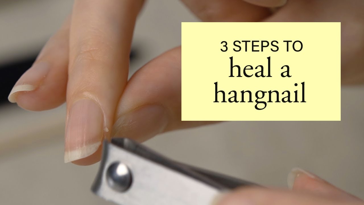 3 Steps to Heal a Hangnail