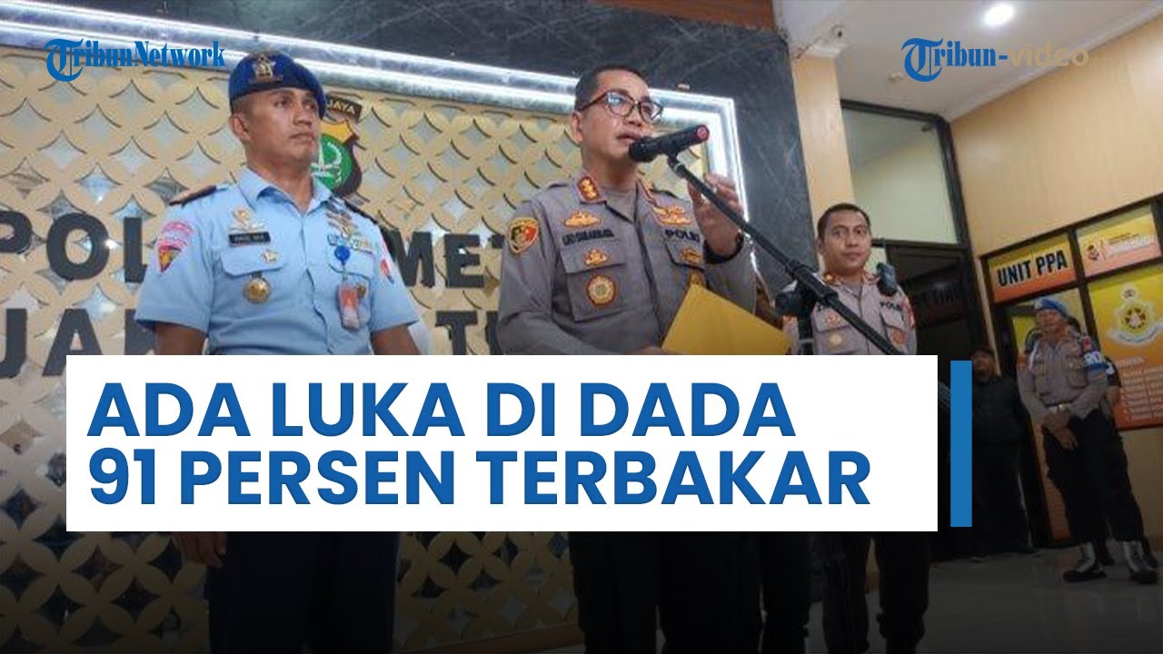 Tewas di Lanud Halim, Anak Perwira TNI AU Alami Luka Bakar 91 Persen ... Tewas di Lanud Halim, Anak Perwira TNI AU Alami Luka Bakar 91 Persen ...