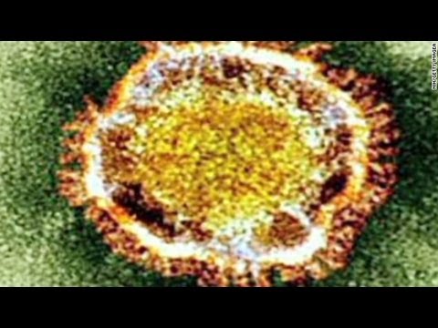 Spreading Deadly Virus Threatens Entire World May 29 2013 SARS