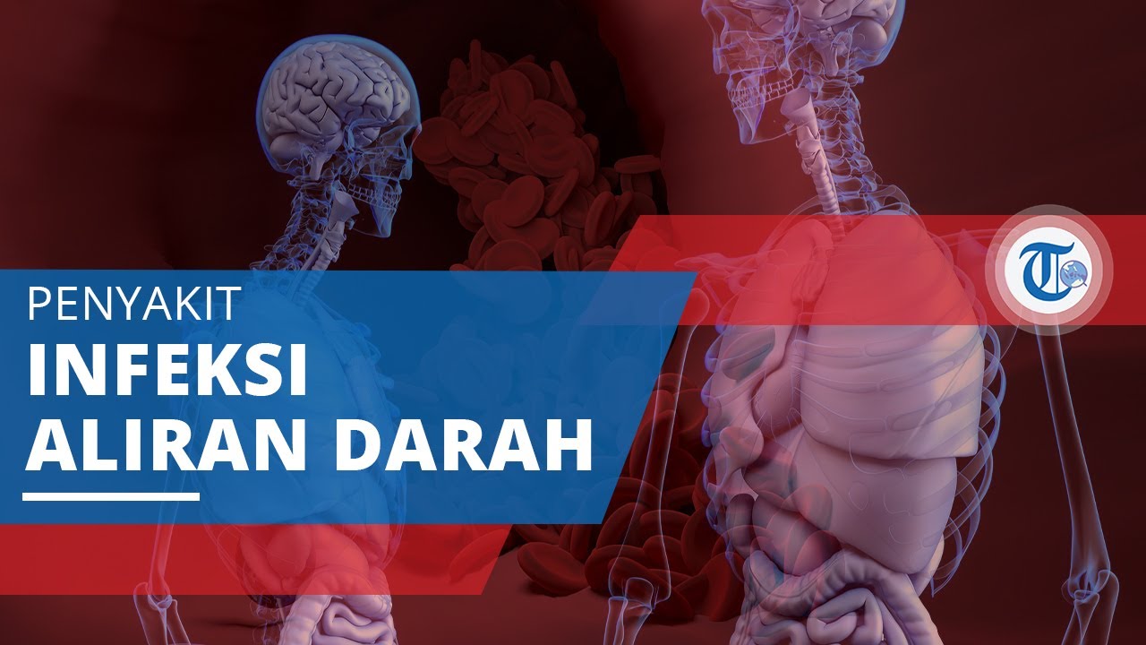 Septikemia, Infeksi yang Terjadi di Aliran Darah - Tribun Video