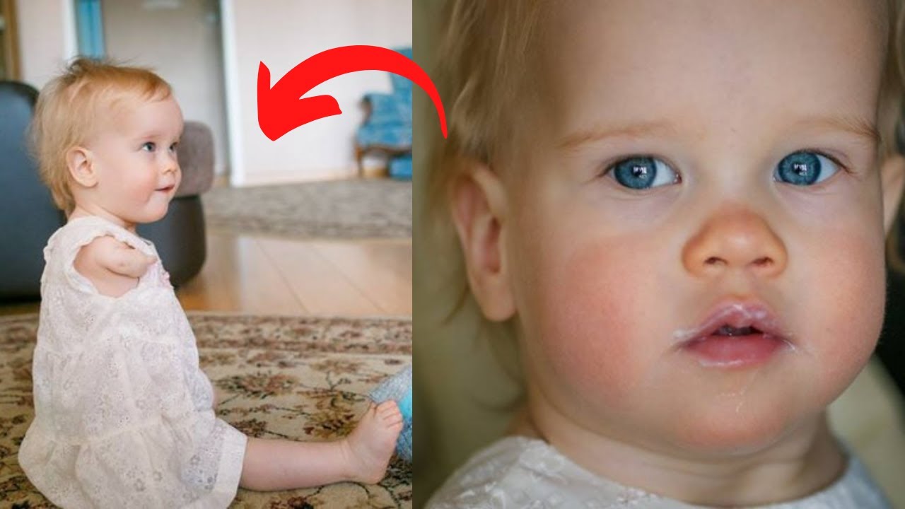 Abandoned armless baby gets adopted. A year later, she’s become an online sensation