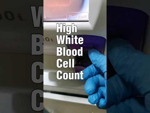 leukocytosis or high WBC count #hematologylab #laboratory #medtechstudent #cls #mls #rmt #bloodcells