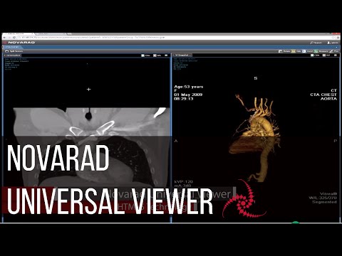 What makes a universal viewer work?