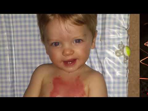 "Discover the Ultimate Wellness Reset: Experience the Power of Tea Burn for a Healthier, Revi