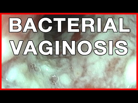 What is Bacterial Vaginosis? Symptoms, Health Risks for Pregnant Women and Treatment