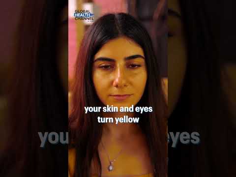 7 signs of Yellow Fever!