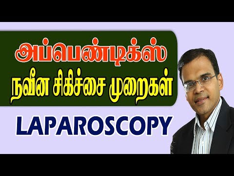 Appendix Appendicitis tamil அப்பெண்டிக்ஸ் நவீன சிகிச்சை லேப்ரோஸ்கோபி Sakthifertility Laparoscopy