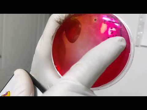 Stool culture - Salmonella (pathogenic) & Proteus (Normal flora) Medical Microbiology workshop