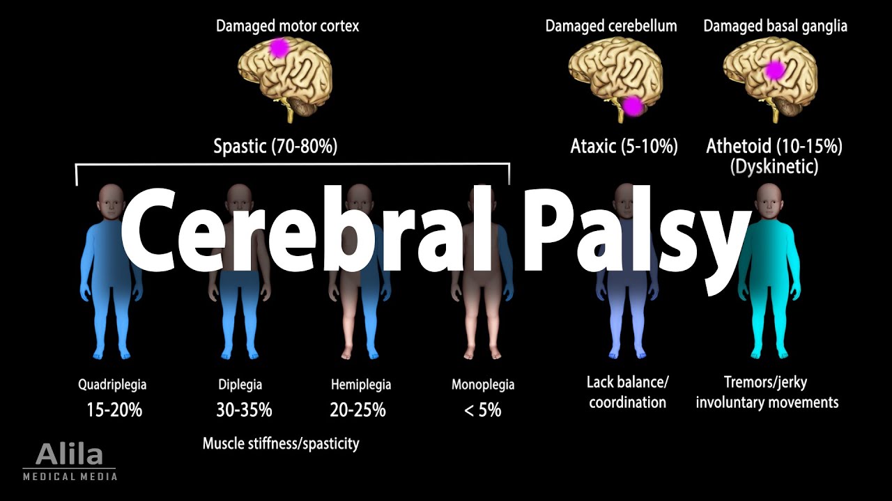 Cerebral Palsy, Animation