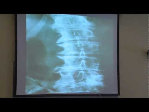 Pain Management and Surgical Options for Arthritis Sufferers