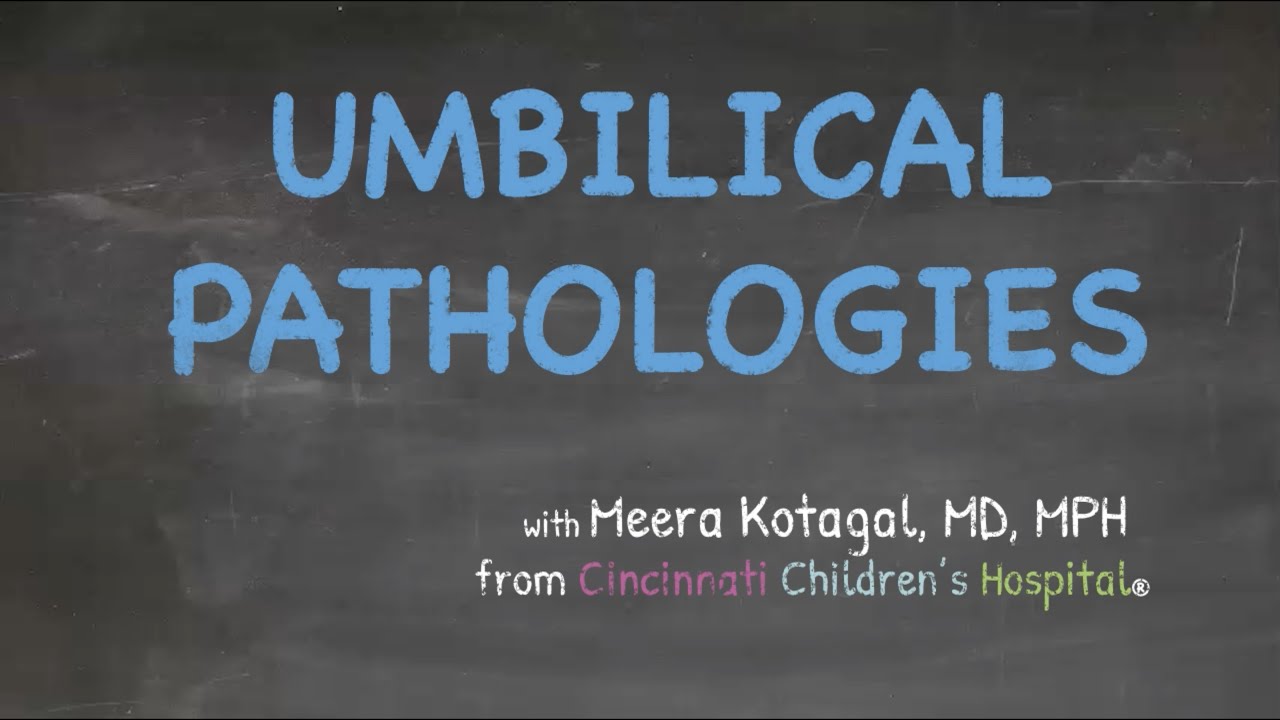 Peds Umbilical Pathologies in Brief: Presentation, Workup, Diagnosis, Perioperative Considerations
