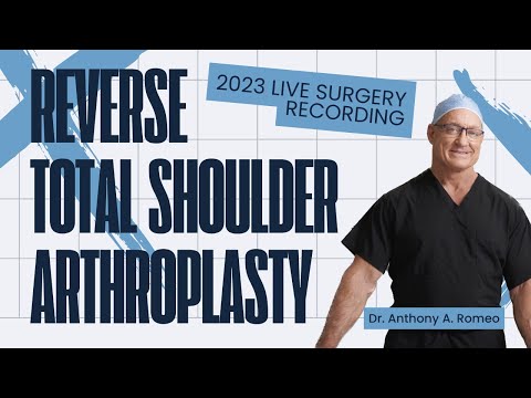 Reverse Total Shoulder Arthroplasty 2023 Live Surgery Recording - Anthony A. Romeo, MD