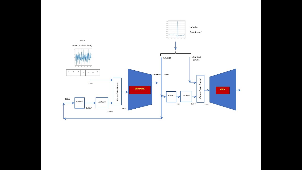ECG Classification using Conditional GAN