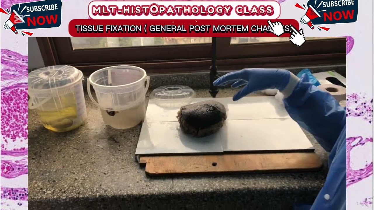 TISSUE FIXATION-GENERAL PST MORTEM CHANGES 