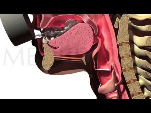 Pharyngo-Esophageal Relationships Video : Michael Groher | MedBridge