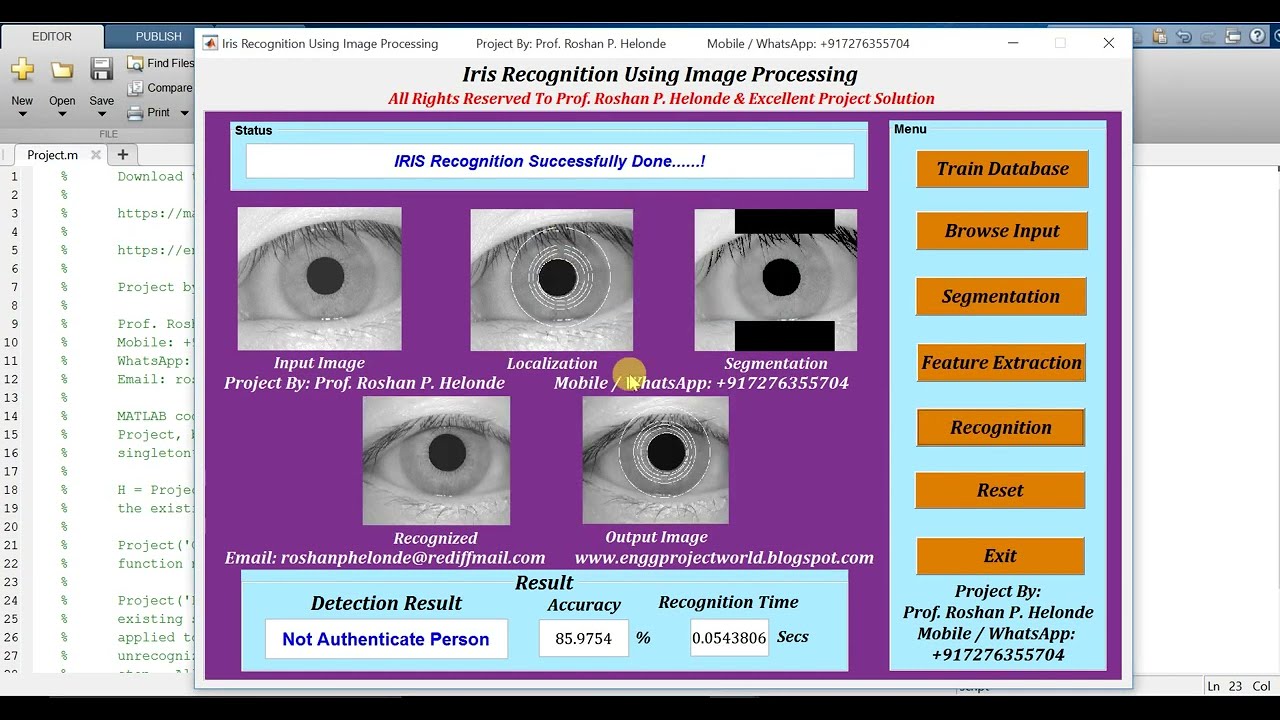 Matlab Code for Iris Recognition Using Image Processing Matlab Project Code Final Year Project
