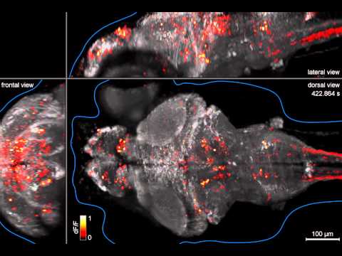 Whole-brain imaging of neuronal activity in a larval zebrafish