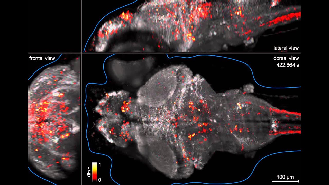 Whole-brain imaging of neuronal activity in a larval zebrafish