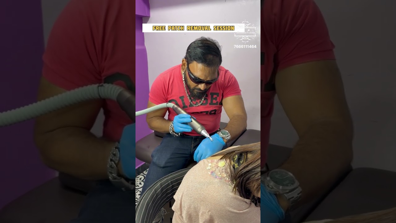 Free Tattoo Removal & Cover-Up Consultation in Mumbai! | Book Now at 7666111464 #free