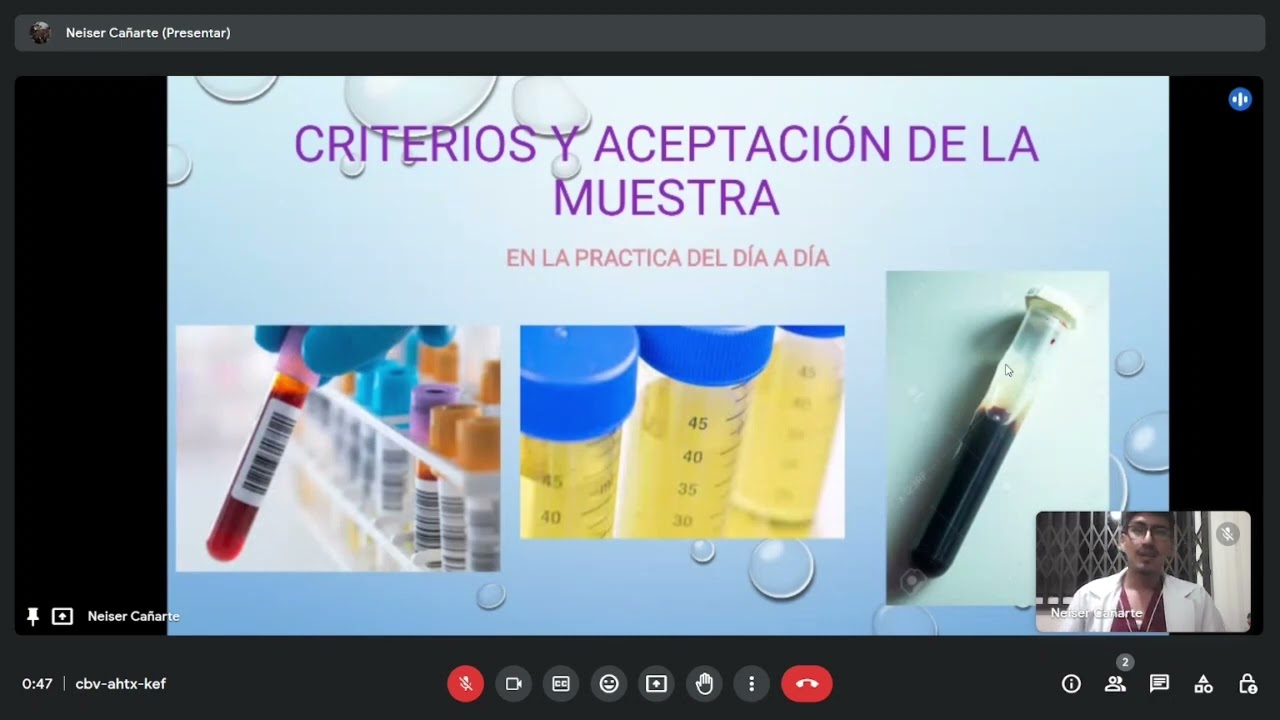 Criterios de aceptación y rechazo de muestras