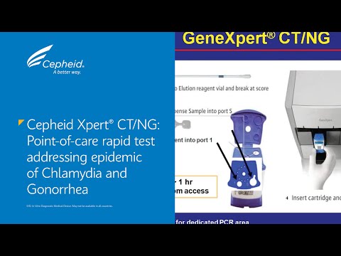 Cepheid Xpert® CT/NG: Point-of-care Rapid Test Addressing Chlamydia and Gonorrhea