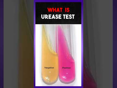 Urease Test | Clear Explain
