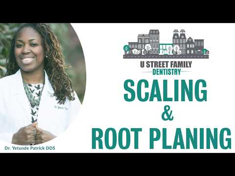 Dr. Patrick | Talks About | Scaling and Root Planing.