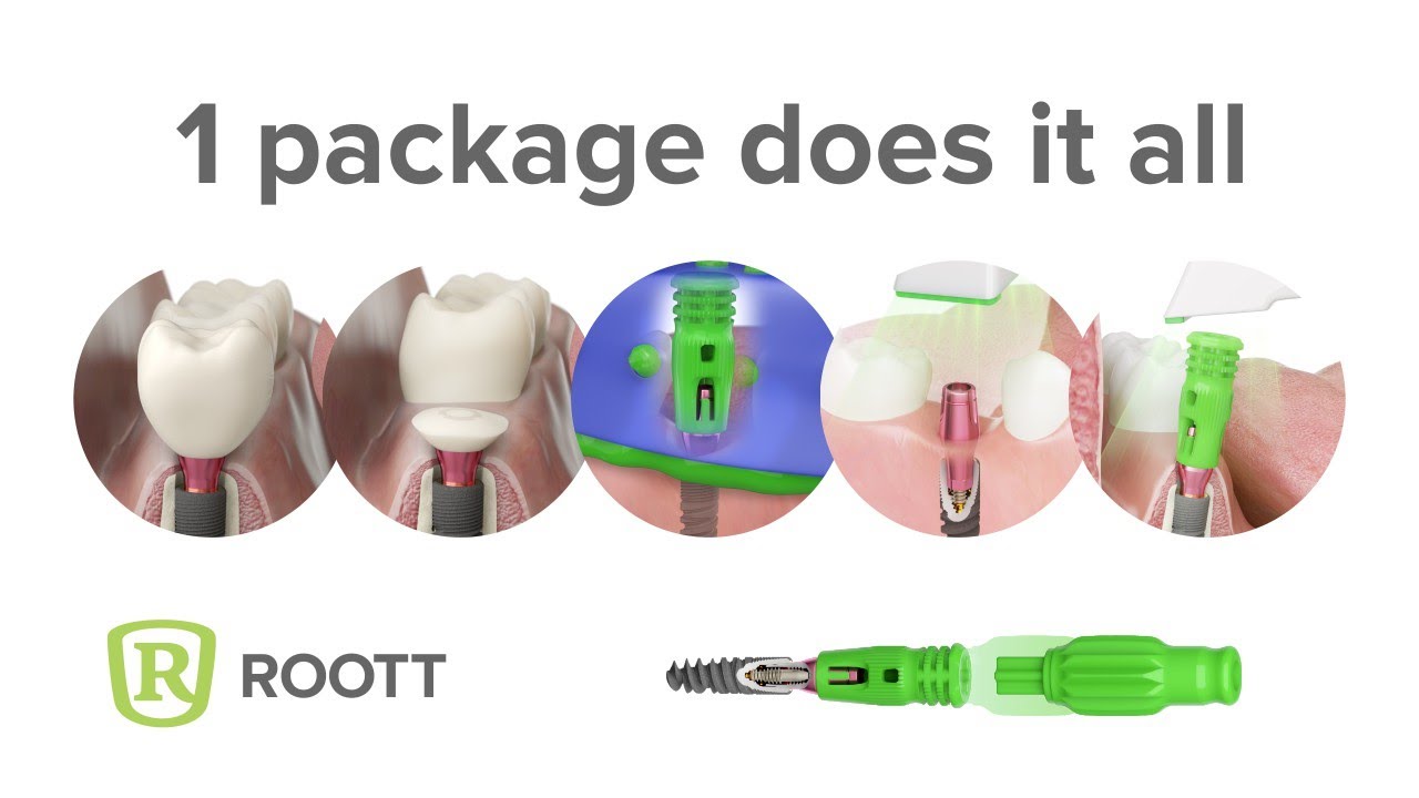 CRE multifunctional abutment - One package does it all