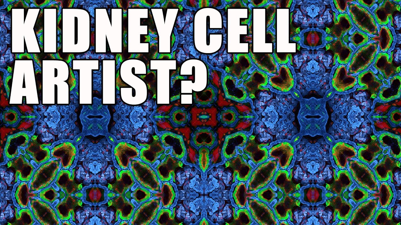 Scientist and Artist: Making Art with Kidney Cells