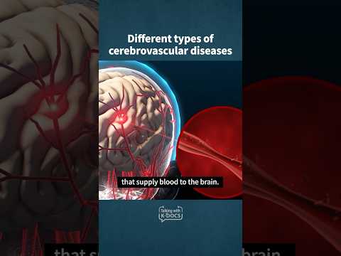 Different types of cerebrovascular diseases!🧠#medicalkorea #koreanmedicine #cerebrovasculardiseas