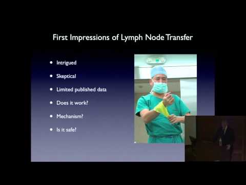 Breakthrough in Lymphedema: Vascularized Lymph Node Transfer