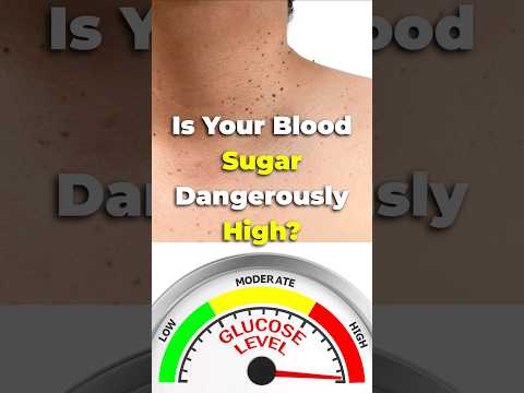 6 ALARMING Signs Your Blood Sugar Is HIGH |Diabetes Symptoms #shorts
