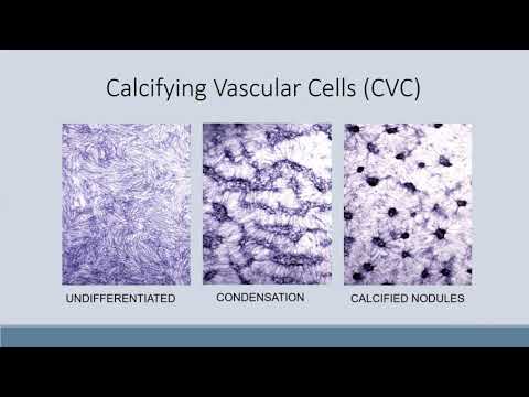 Coronary Artery Calcification November 8 2019