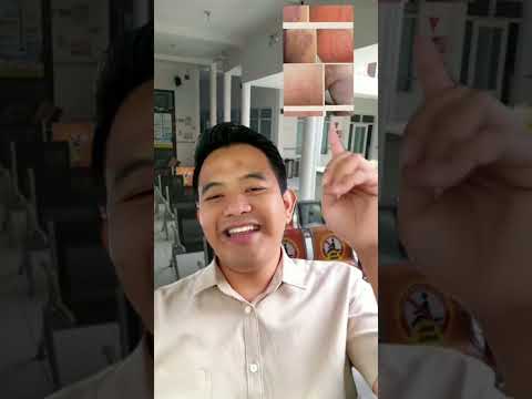 ayo ngaku yg sering gatel di selangkangan🤣🤣