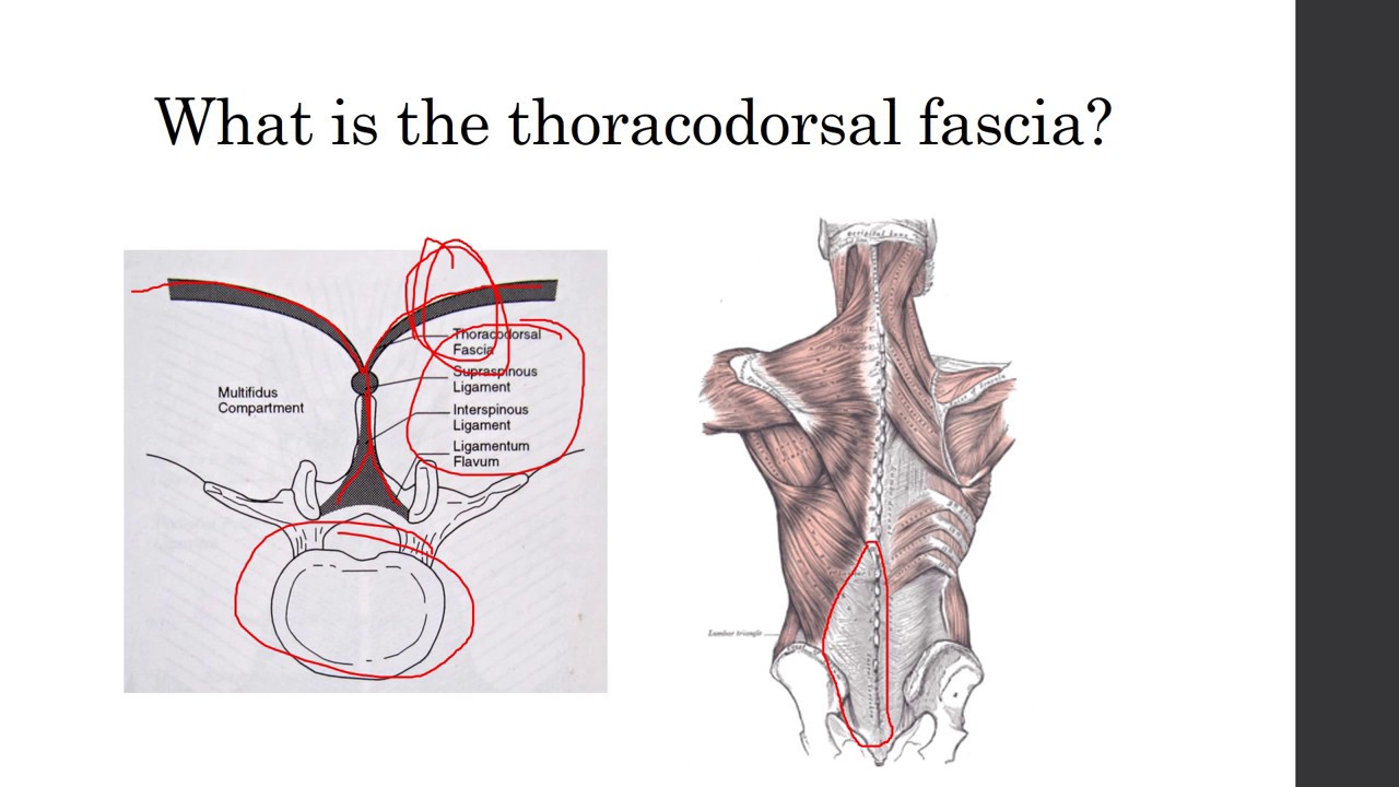 Pain After Back Surgery? Did the Surgeon Leave a Big Hole in Your ...