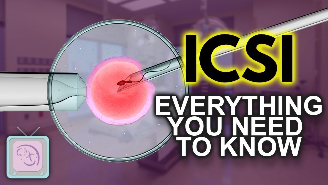 IVF ICSI Procedure - Important things you need to know