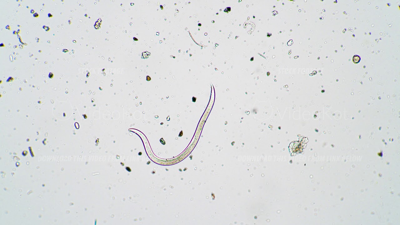 Roundworm nematode moves in fresh water under a microscope close up