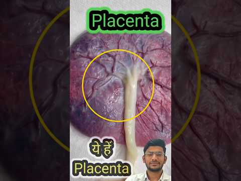 Placenta / Umbilical Cord 😱.... #Placenta #pregnancy #umbilical #labour #baby #doctor