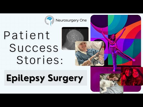 DBS: Epilepsy surgery to manage seizures
